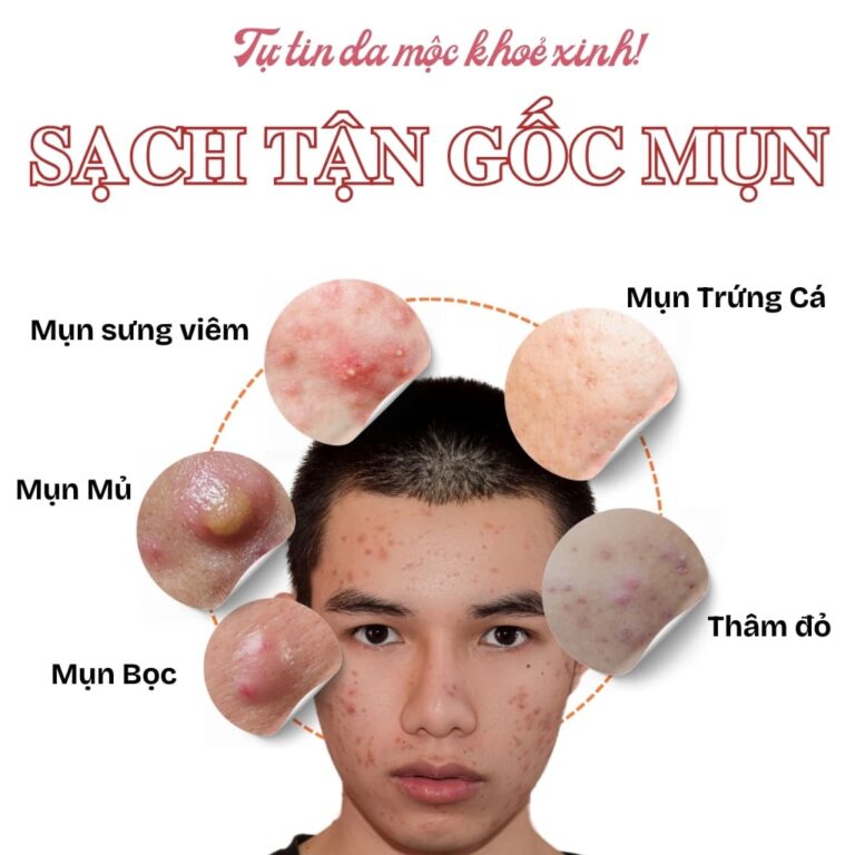 Top 10+ Serum trị thâm mụn hiệu quả, tốt nhất được chị em tin dùng
